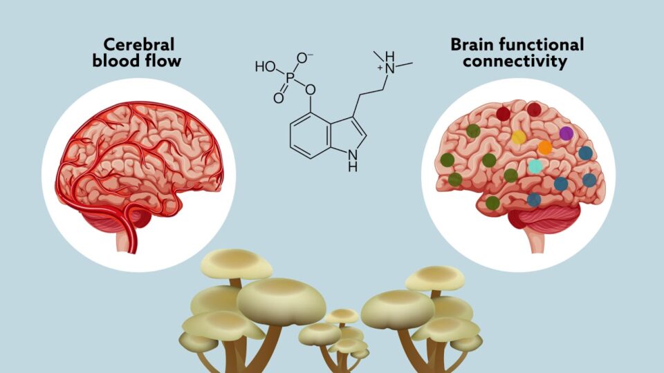 Shroom Brain: Your Brain on Magic Mushrooms - Mind Debris Magazine